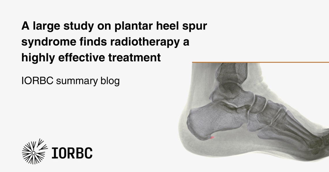 Heel spur syndrome | IORBC